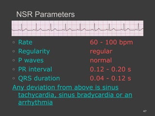Basic ecg interpretations | PDF