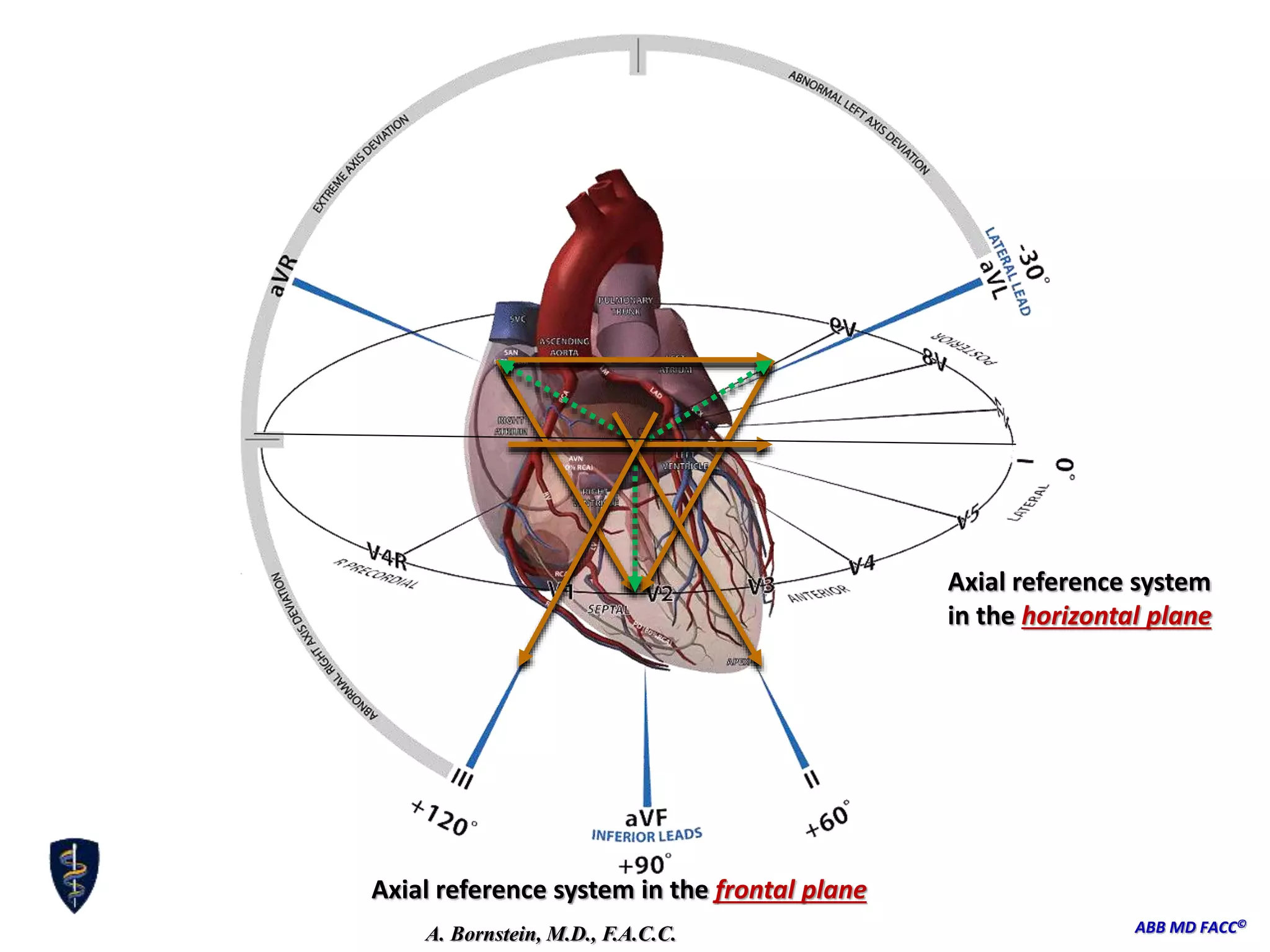 Basic ECG lecture 04 26 2018 | PPT