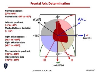 Basic ECG lecture 04 26 2018 | PPT