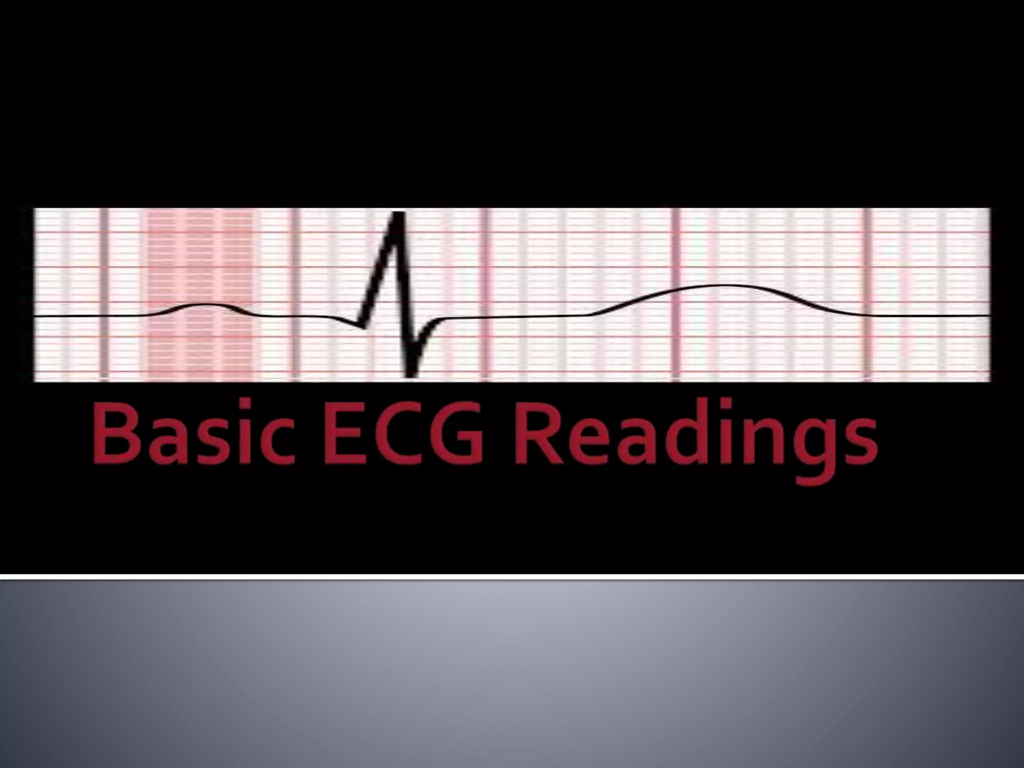 Basic ECG Readings.pptx