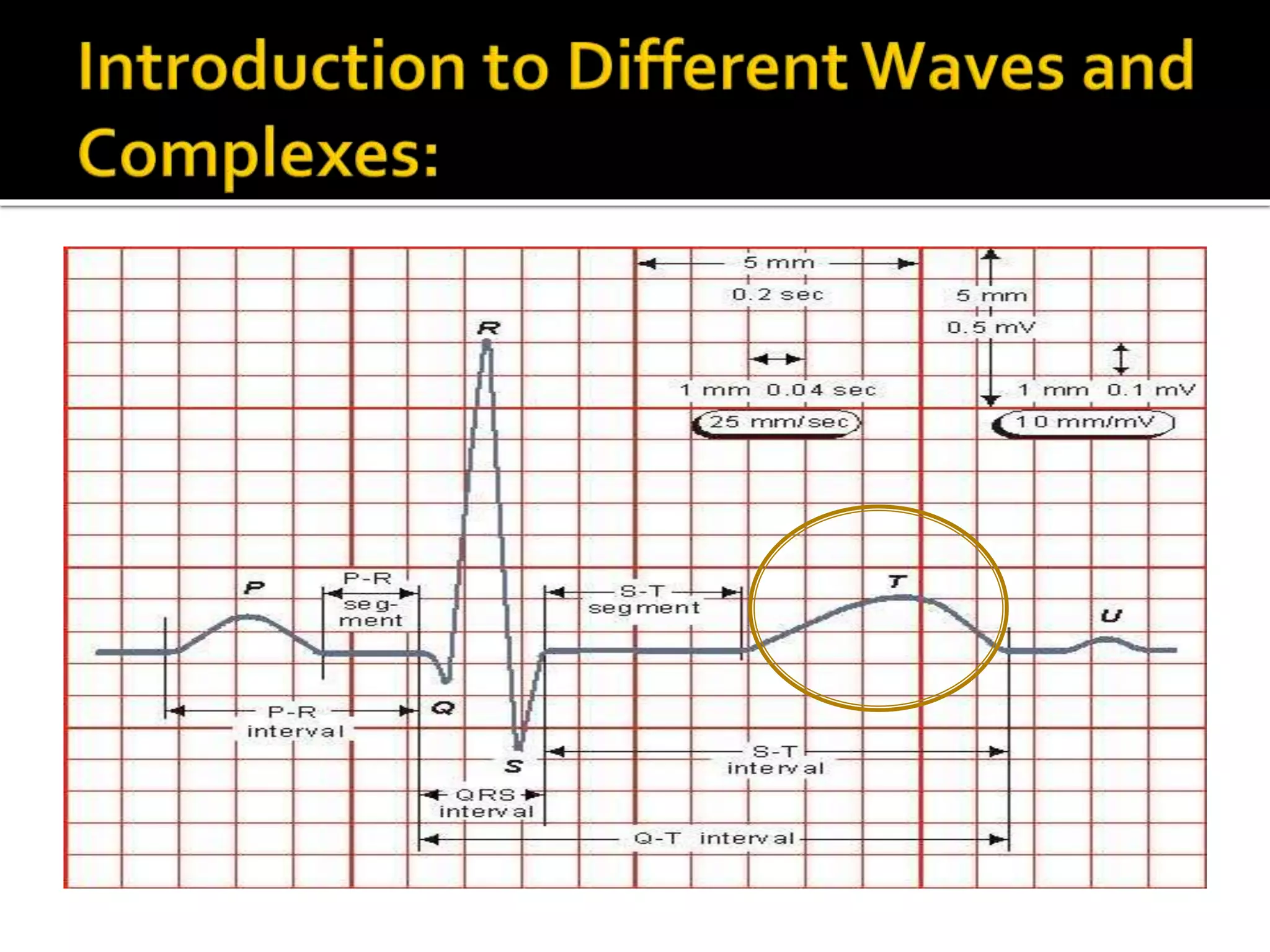 Basic ECG Readings.pptx