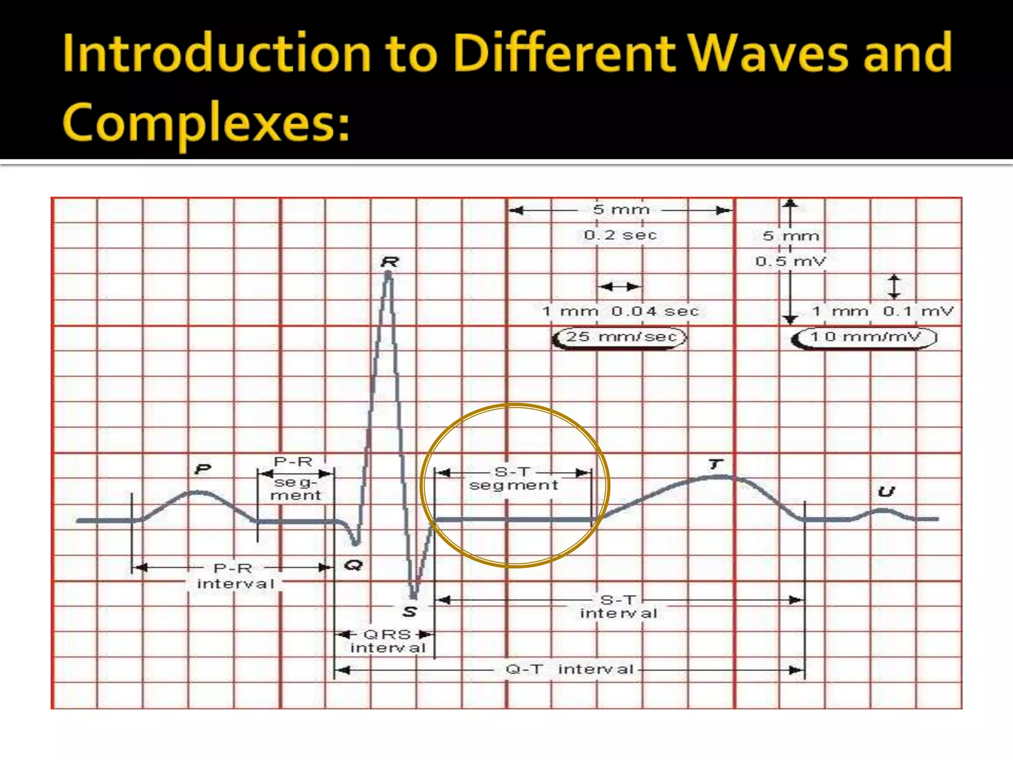 Basic ECG Readings.pptx