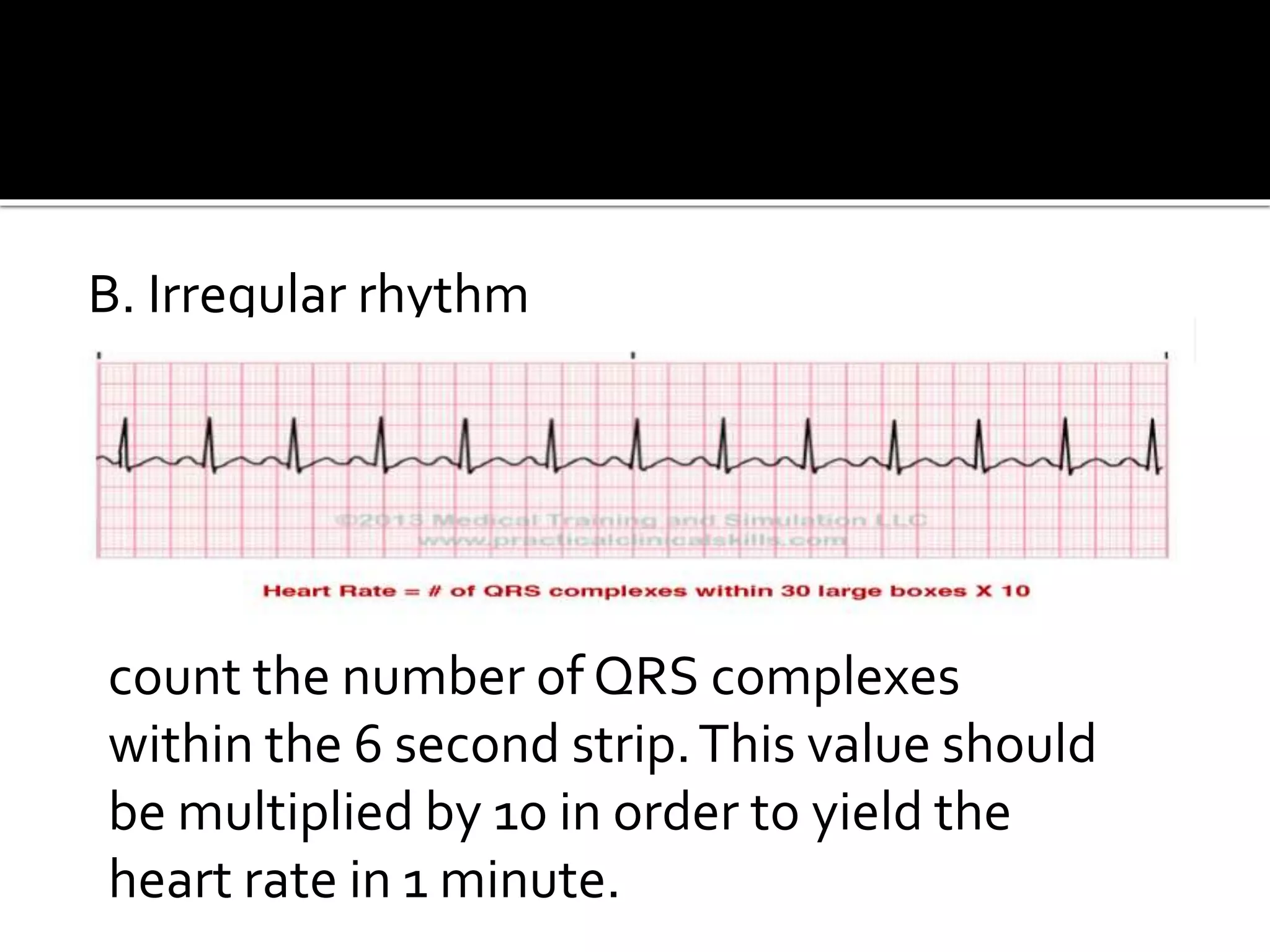Basic ECG Readings.pptx