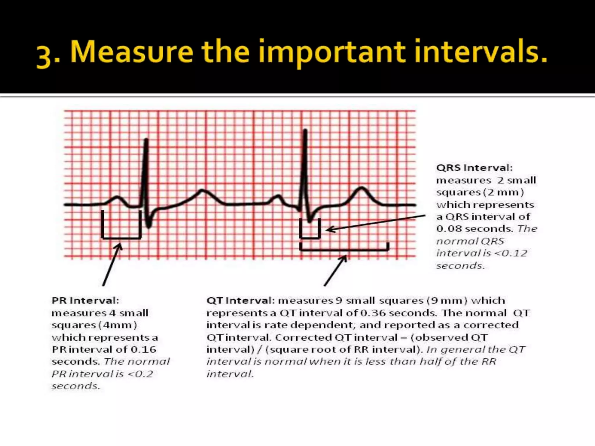 Basic ECG Readings.pptx