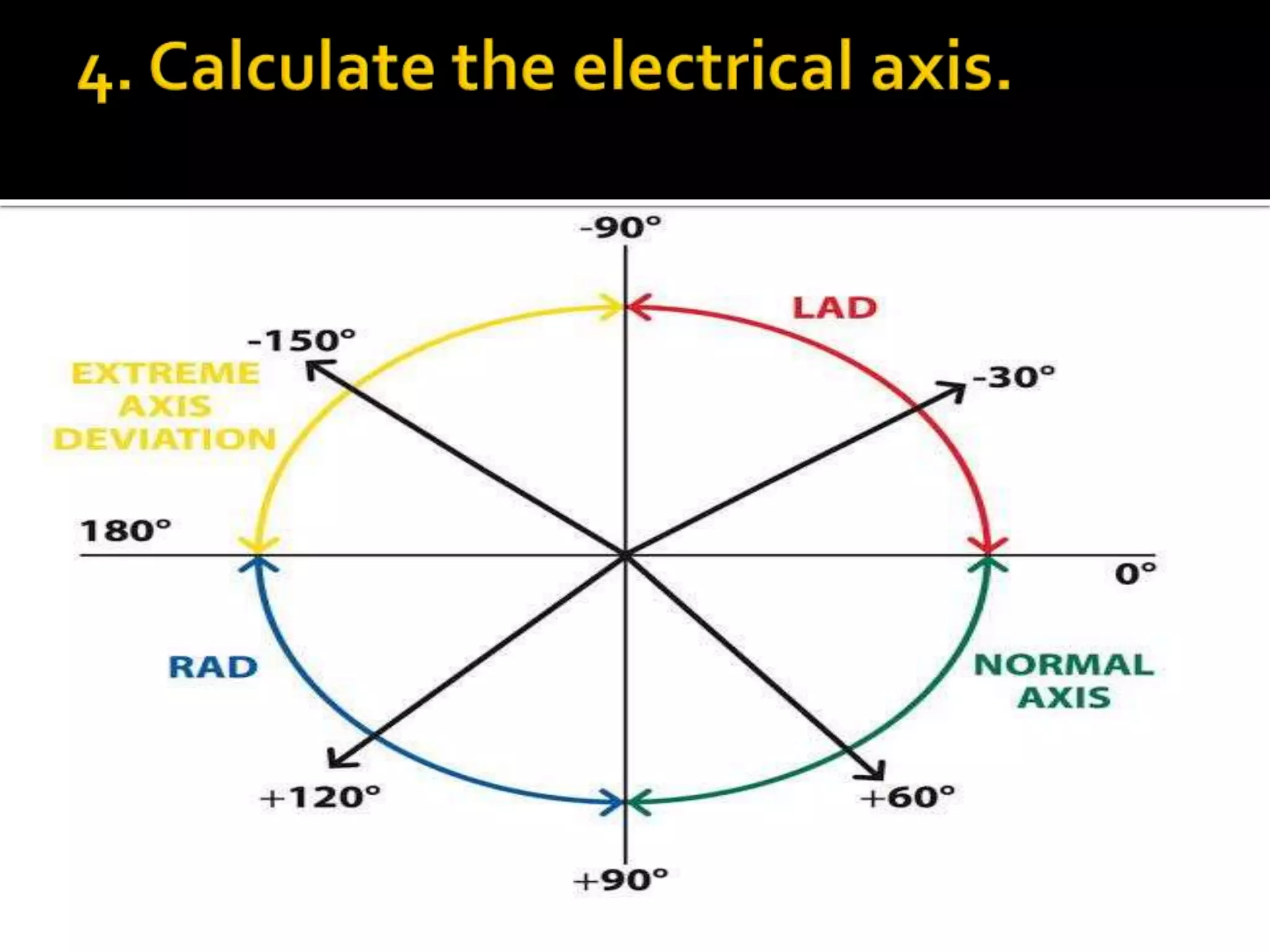 Basic Ecg Readings Pptx