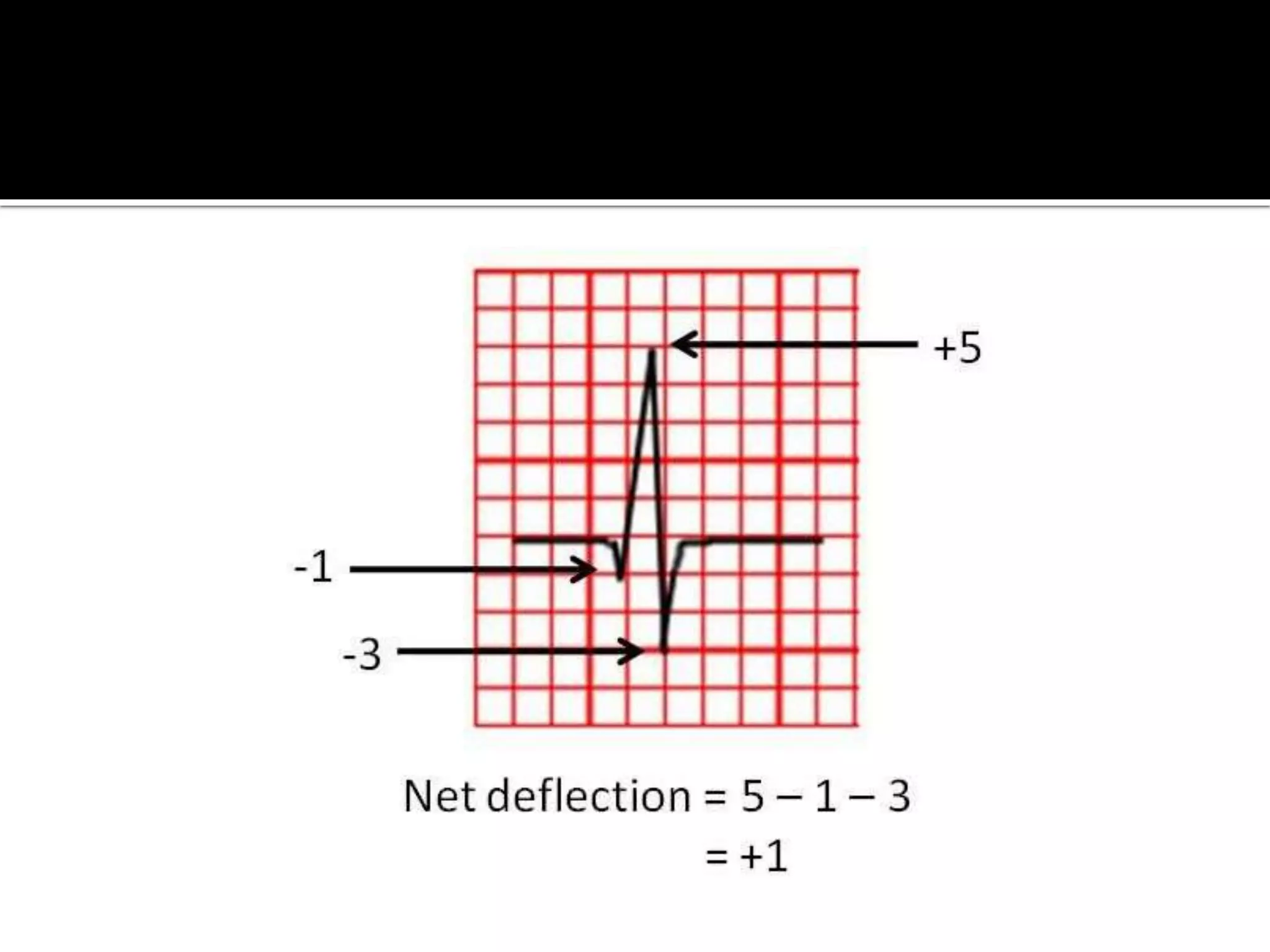 Basic ECG Readings.pptx