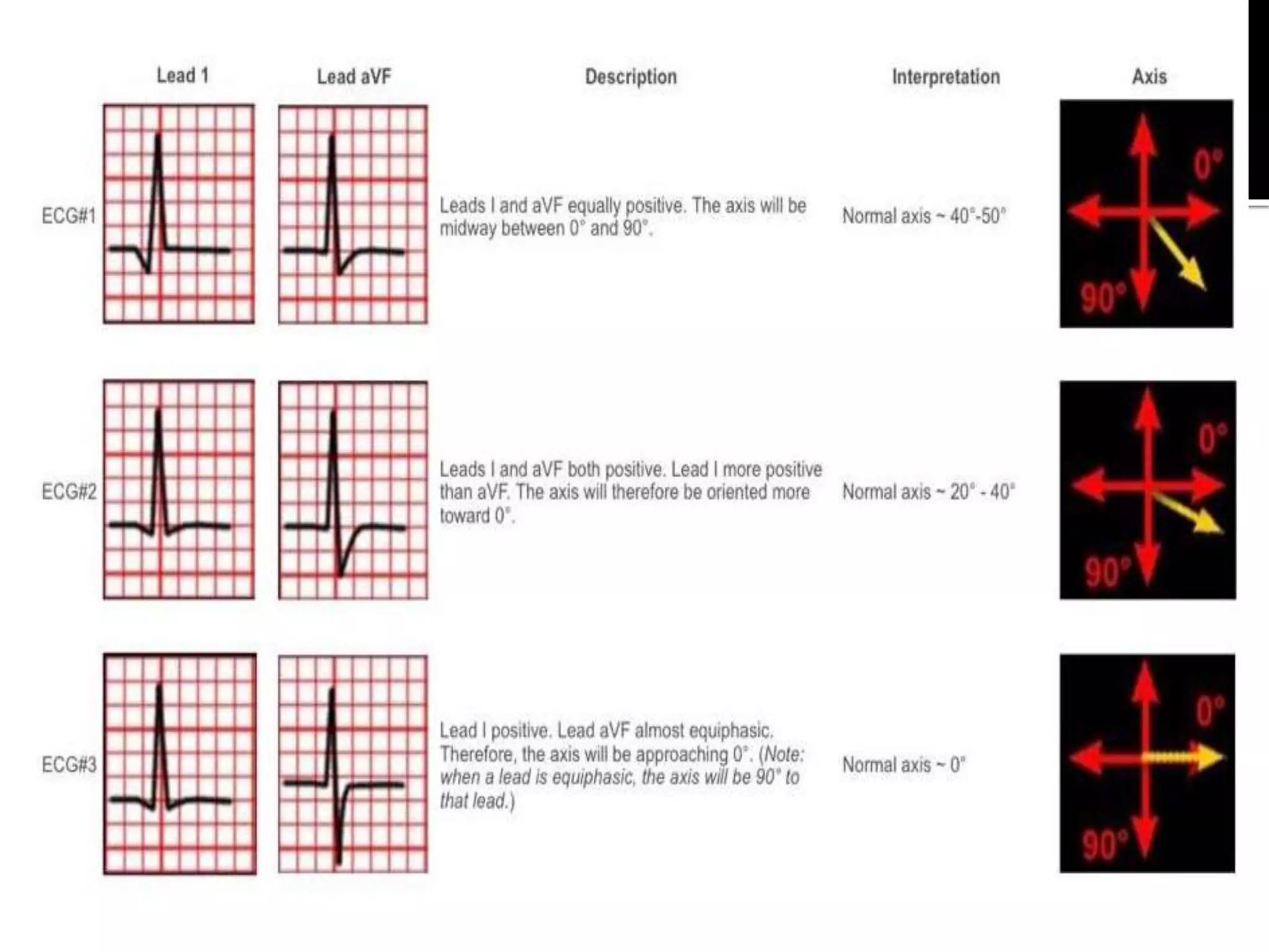 Basic ECG Readings.pptx