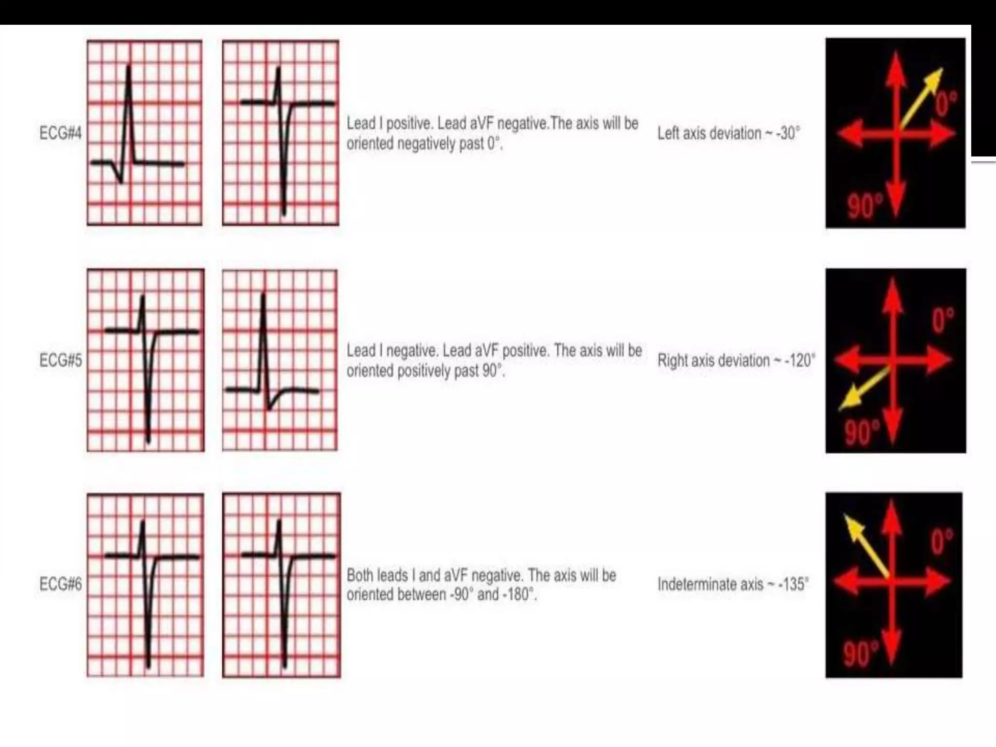 Basic ECG Readings.pptx
