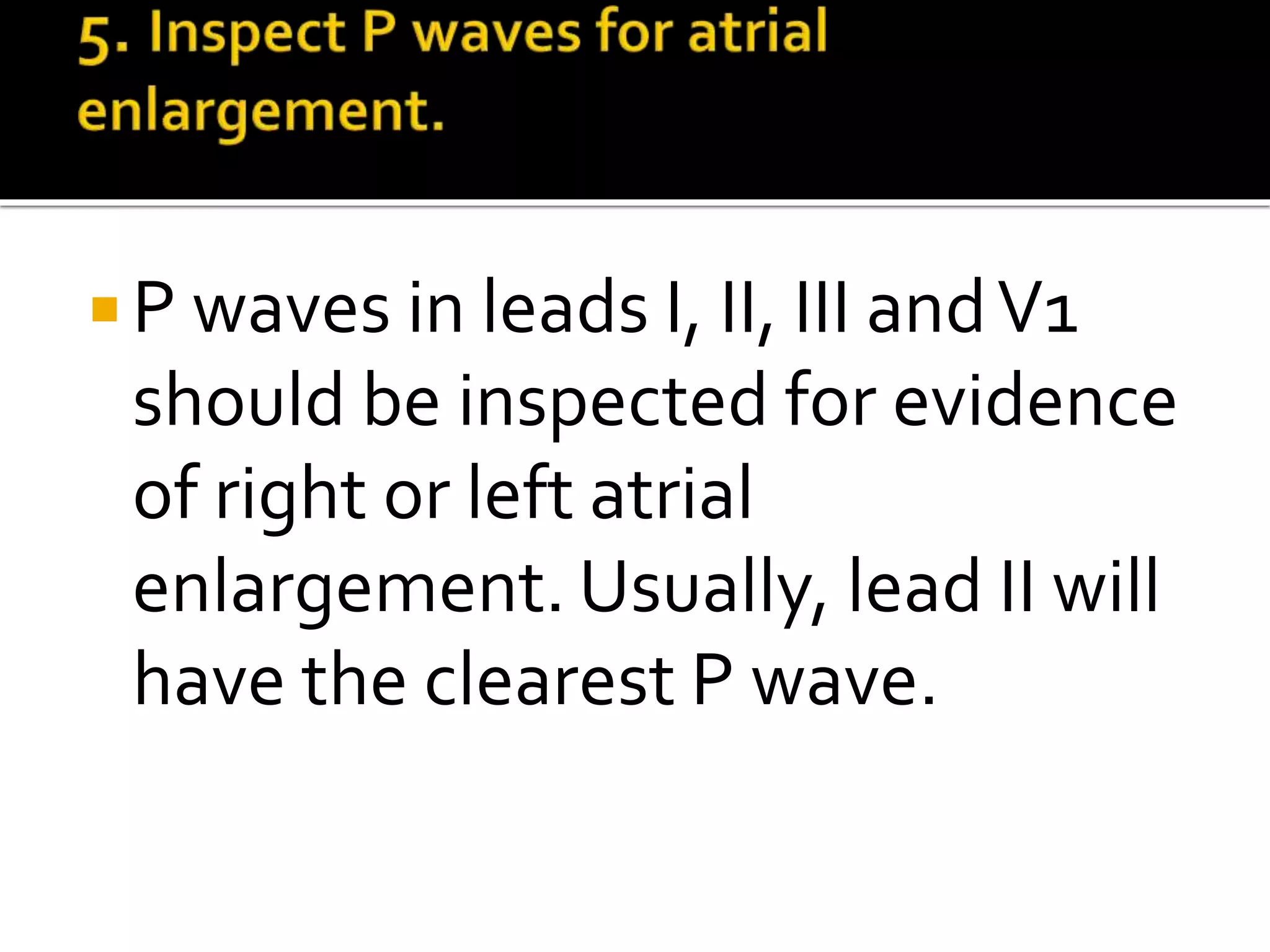Basic Ecg Readings Pptx