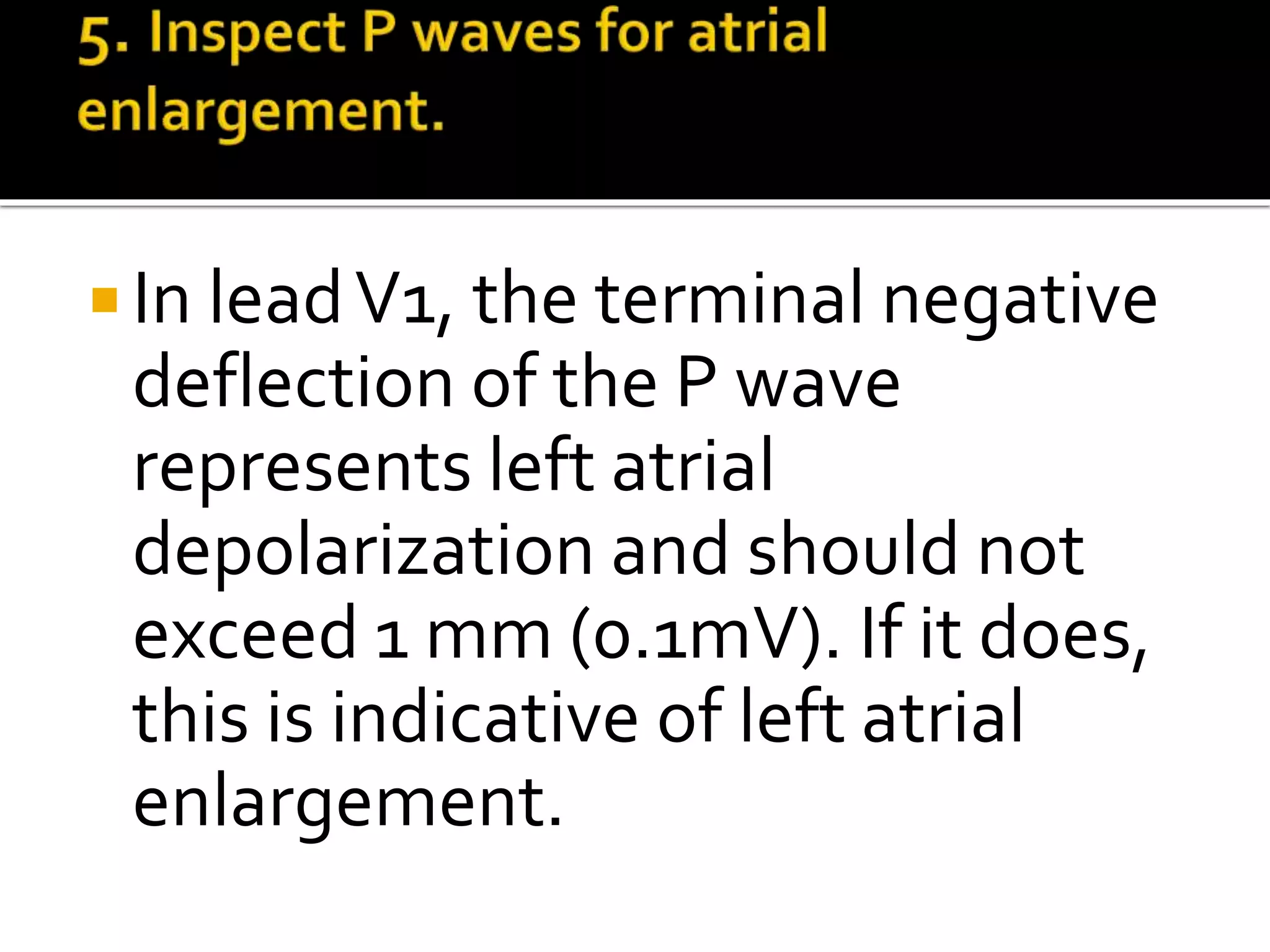 Basic Ecg Readings Pptx