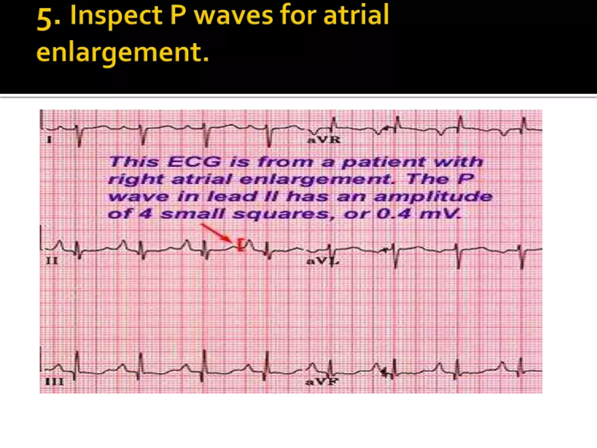 Basic ECG Readings.pptx