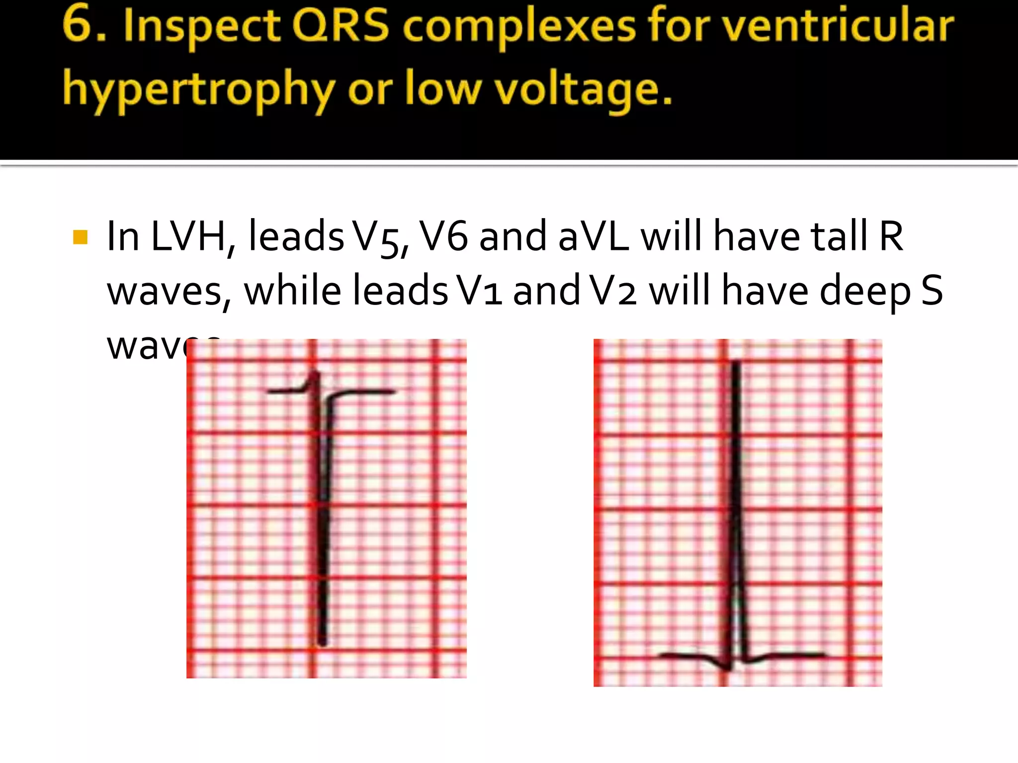 Basic ECG Readings.pptx