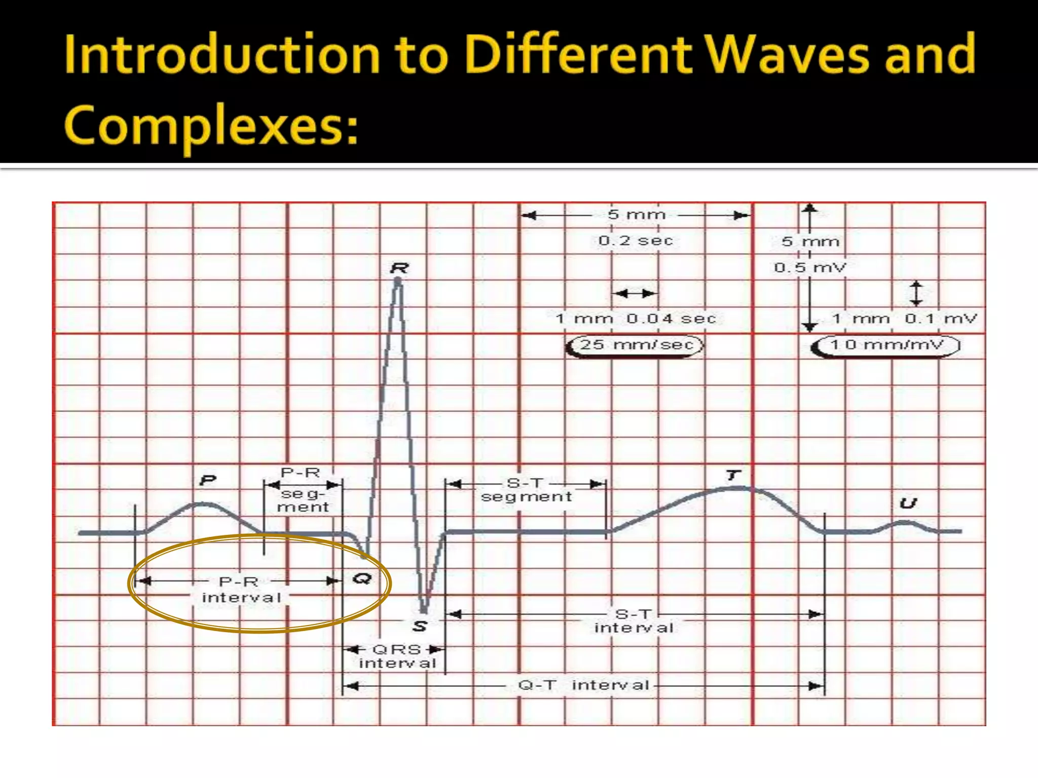 Basic ECG Readings.pptx