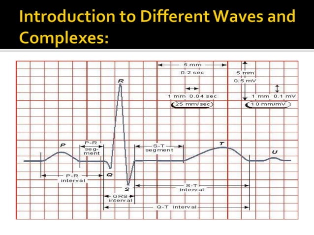 Basic ECG Readings.pptx