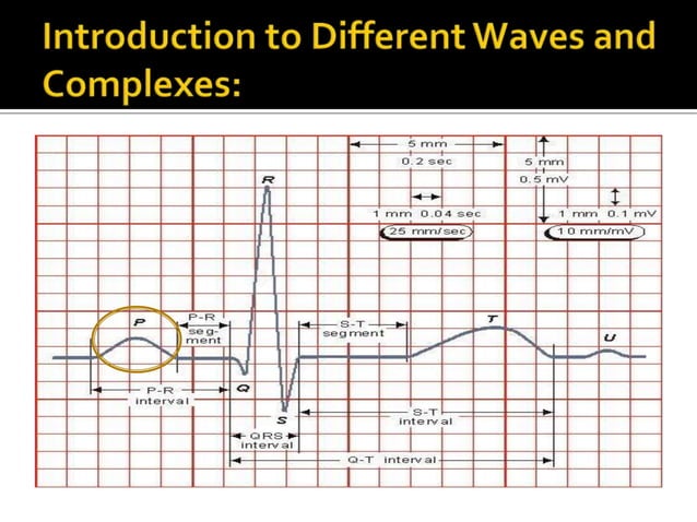 Basic ECG Readings.pptx