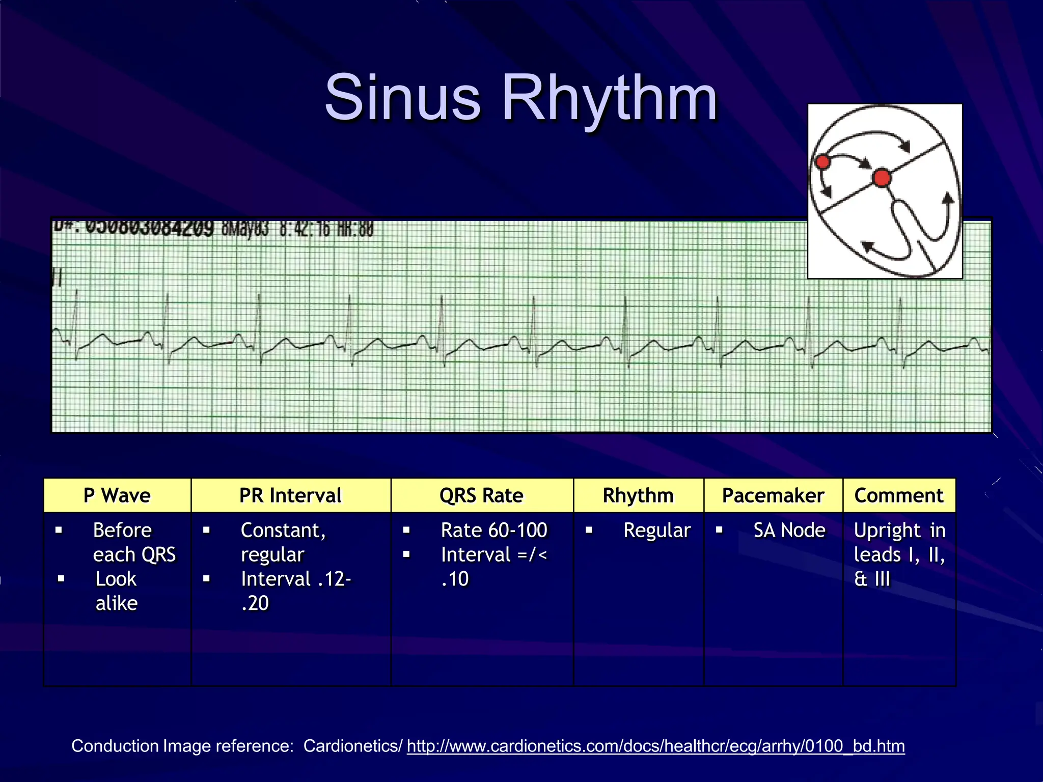 BASIC ECG RTHYM RAJI.pptx ACLS PREPARATION | PPT