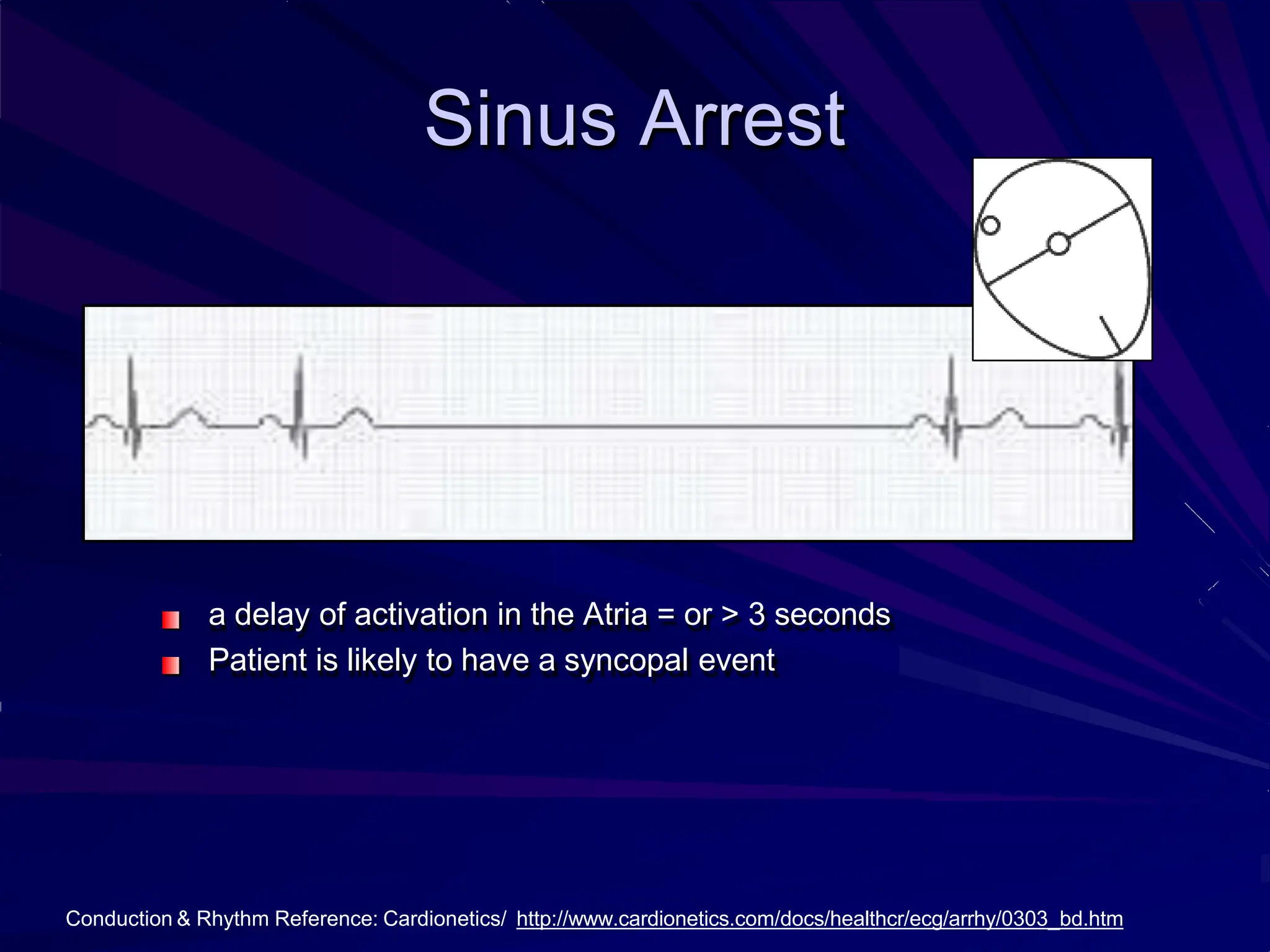 BASIC ECG RTHYM RAJI.pptx ACLS PREPARATION | PPT
