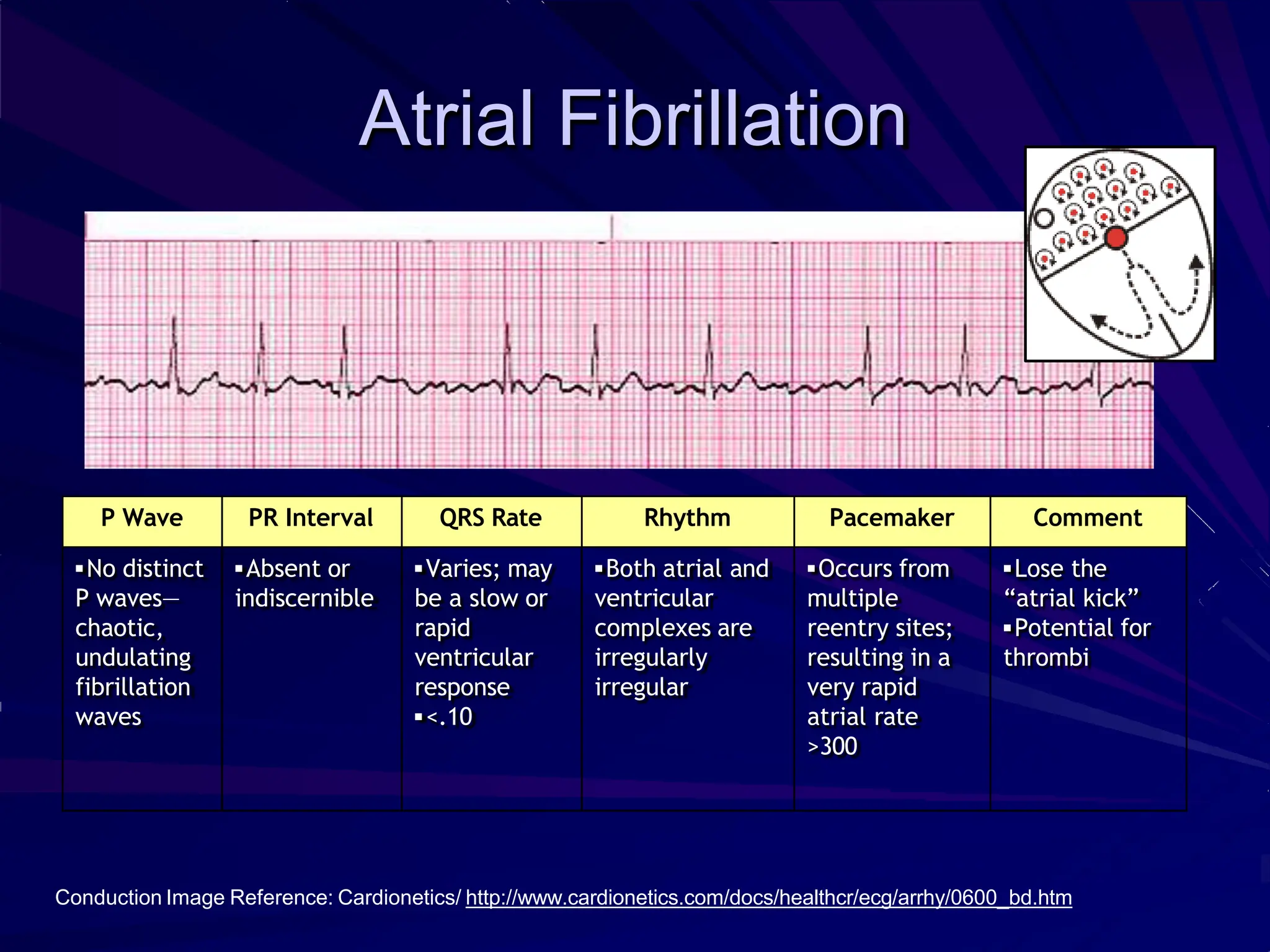 BASIC ECG RTHYM RAJI.pptx ACLS PREPARATION | PPT
