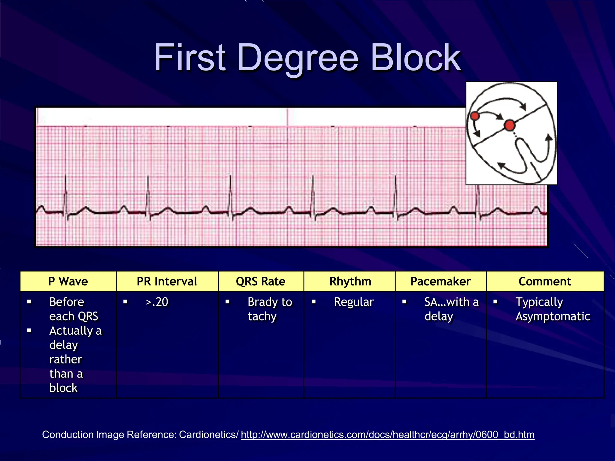 BASIC ECG RTHYM RAJI.pptx ACLS PREPARATION | PPT