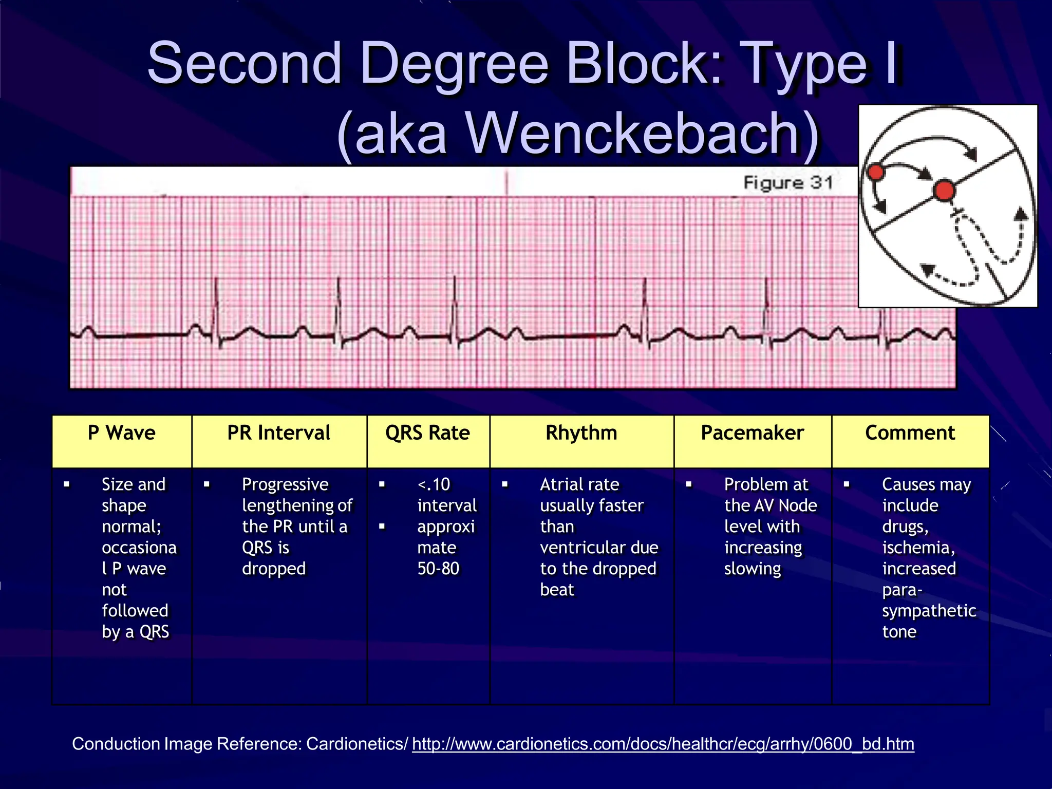 BASIC ECG RTHYM RAJI.pptx ACLS PREPARATION | PPT