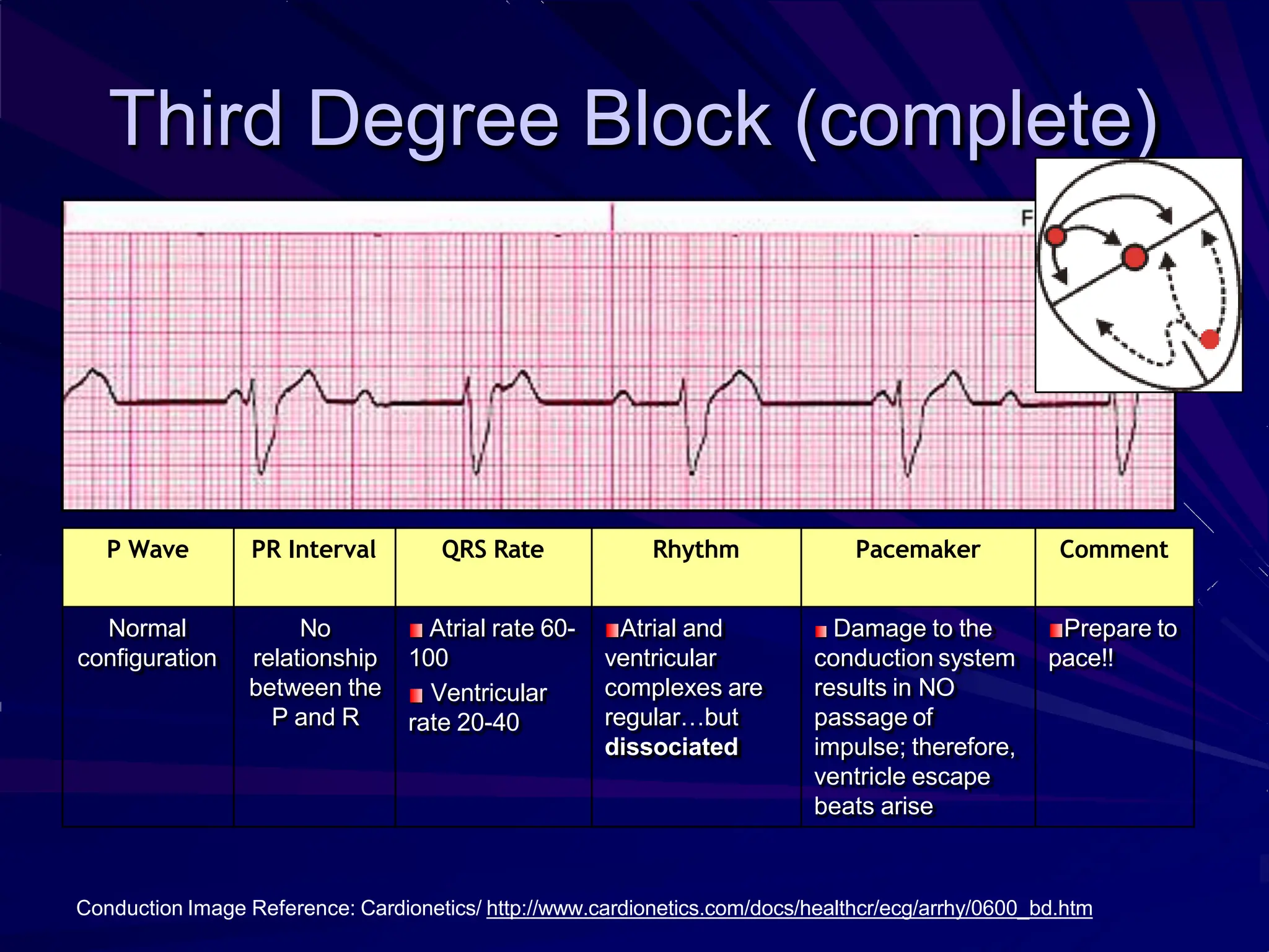 BASIC ECG RTHYM RAJI.pptx ACLS PREPARATION | PPT