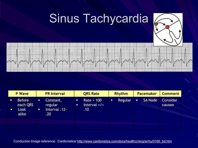 BASIC ECG RTHYM RAJI.pptx ACLS PREPARATION | PPT