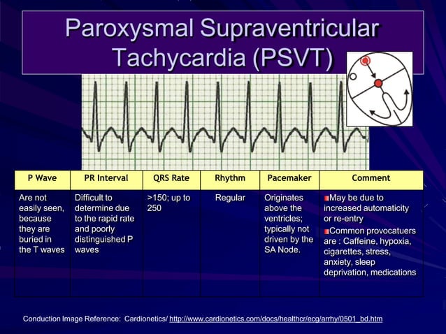BASIC ECG RTHYM RAJI.pptx ACLS PREPARATION | PPT
