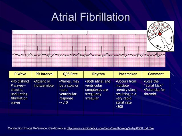 BASIC ECG RTHYM RAJI.pptx ACLS PREPARATION | PPT
