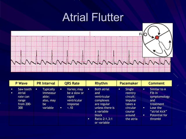 BASIC ECG RTHYM RAJI.pptx ACLS PREPARATION | PPT