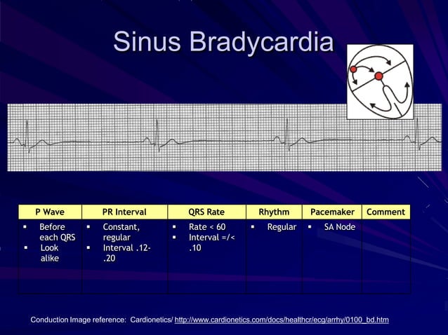 BASIC ECG RTHYM RAJI.pptx ACLS PREPARATION | PPT