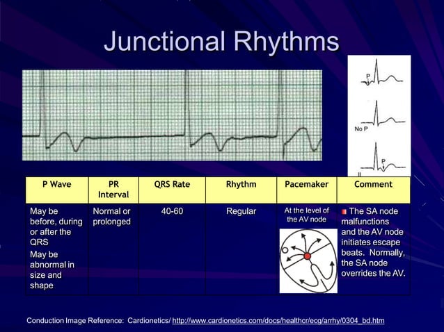 BASIC ECG RTHYM RAJI.pptx ACLS PREPARATION | PPT