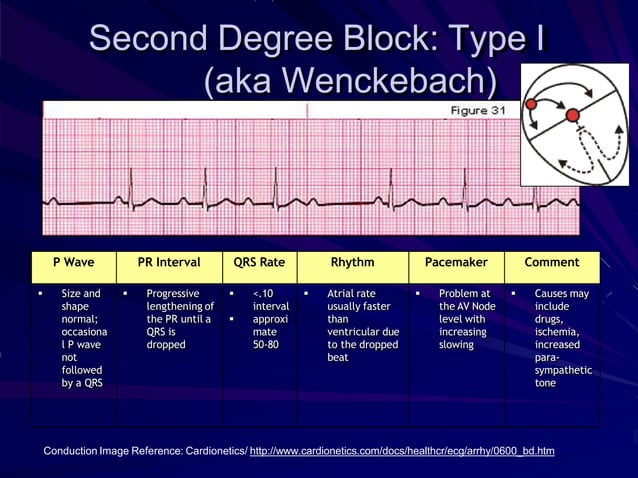 BASIC ECG RTHYM RAJI.pptx ACLS PREPARATION | PPT