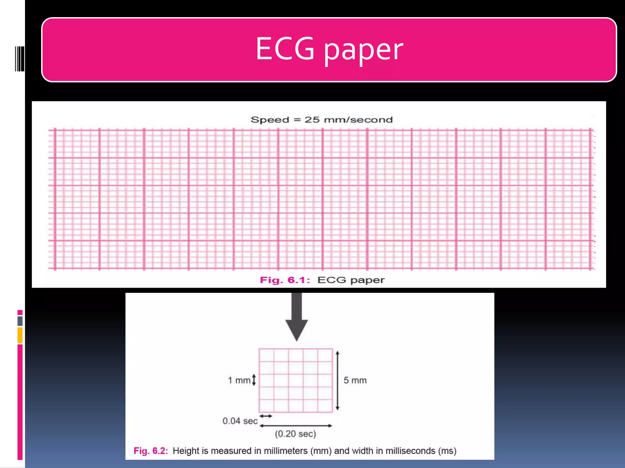Basic ECG &rhythm interpretation | PDF