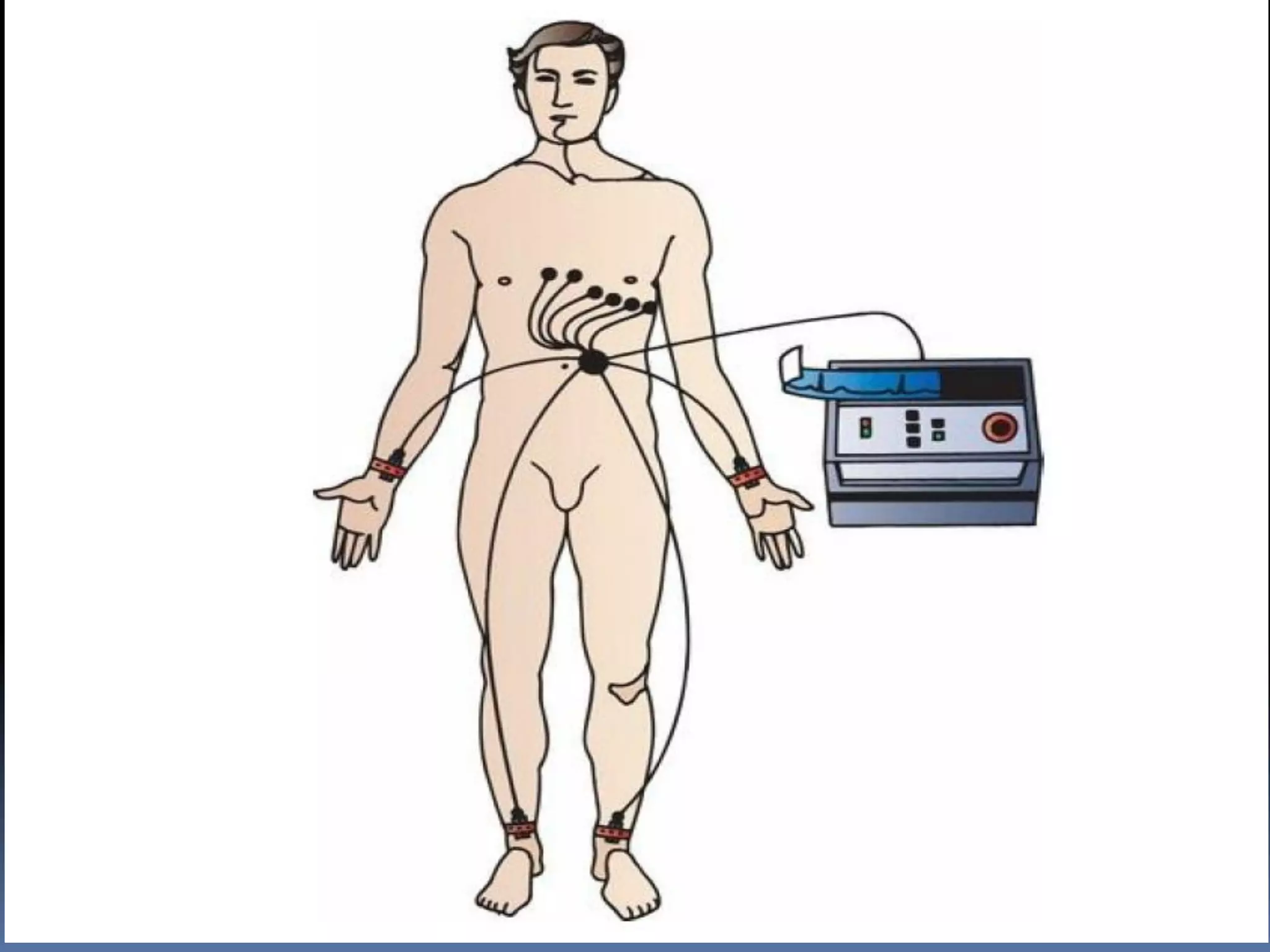 Basic Ecg Andrhythm Interpretation Pdf