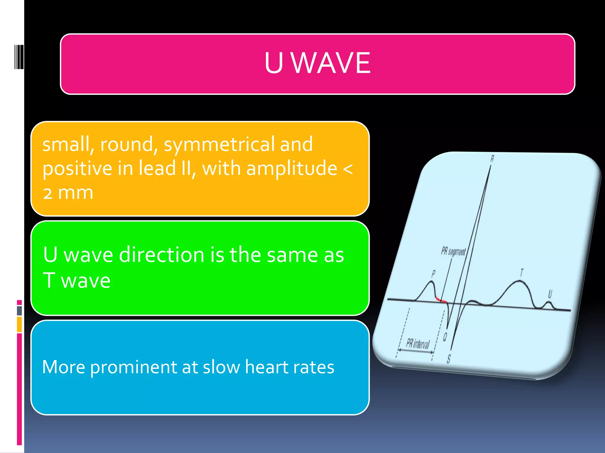 Basic ECG &rhythm interpretation | PDF