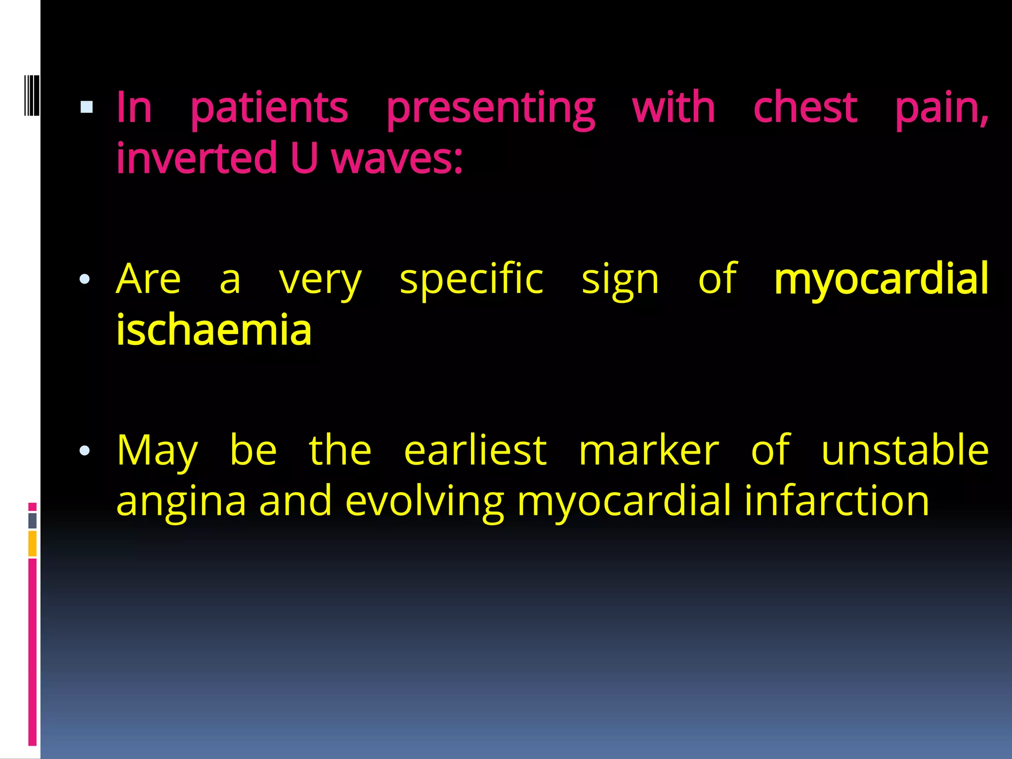 Basic ECG &rhythm interpretation | PDF