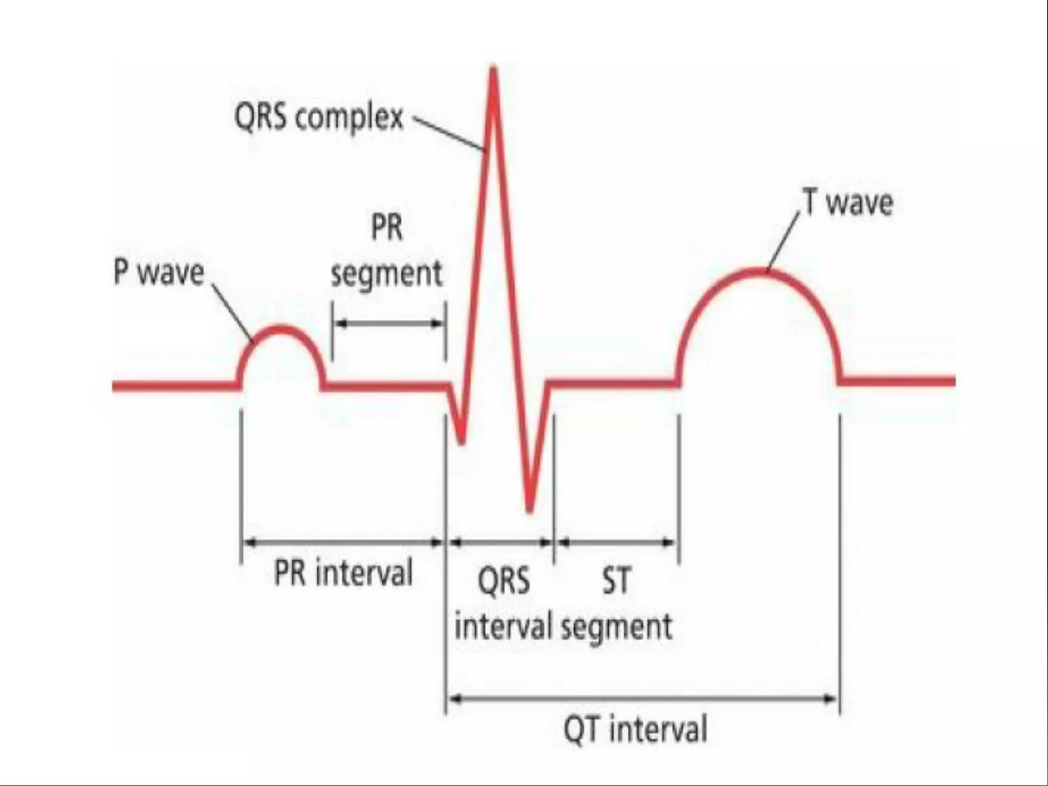 Basic ECG &rhythm interpretation | PDF