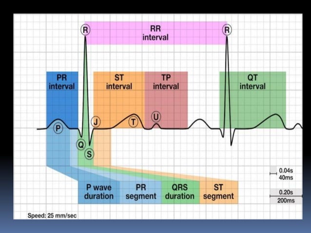 Basic ECG &rhythm interpretation | PDF