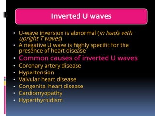 Basic ECG &rhythm interpretation | PDF