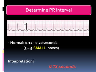 Basic ECG &rhythm interpretation | PDF