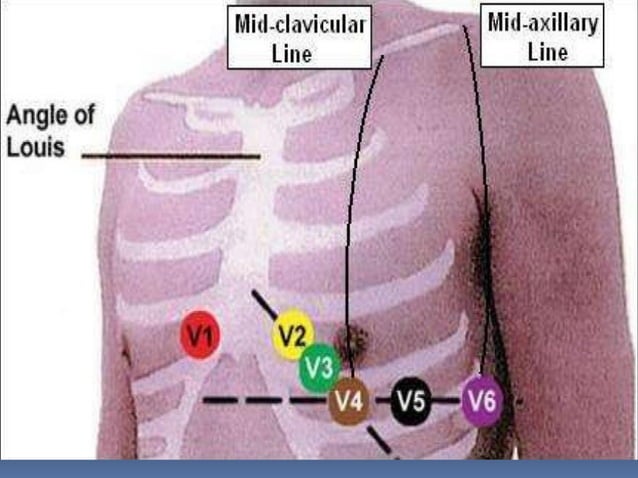 Basic ECG &rhythm interpretation | PDF
