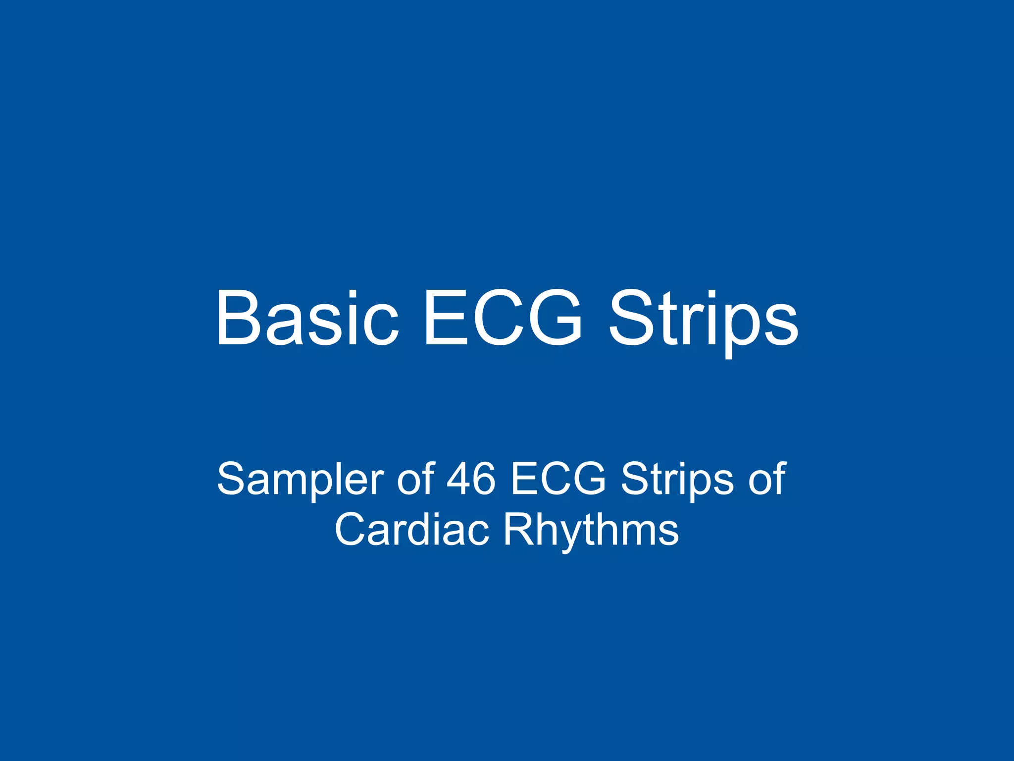 Basic ecg stripsnew | PPT