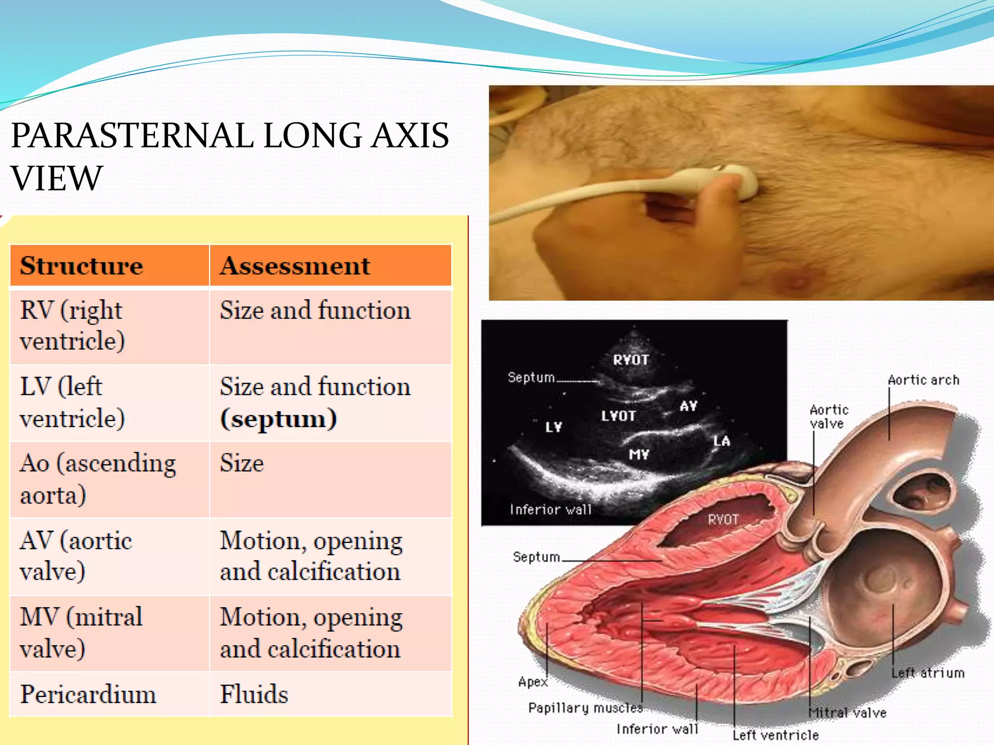 Basic echocardiography | PPTX
