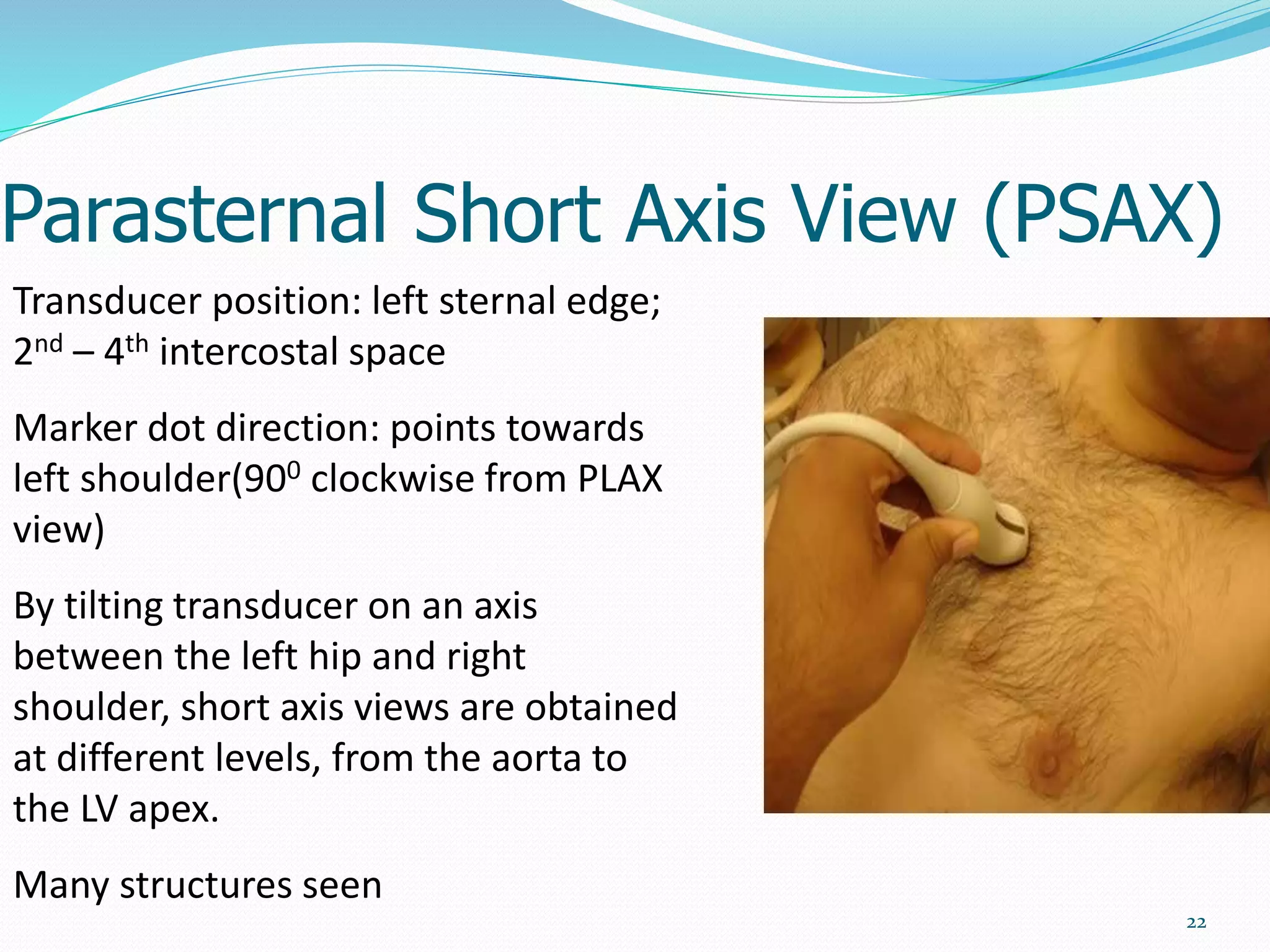 Basic echocardiography | PPTX