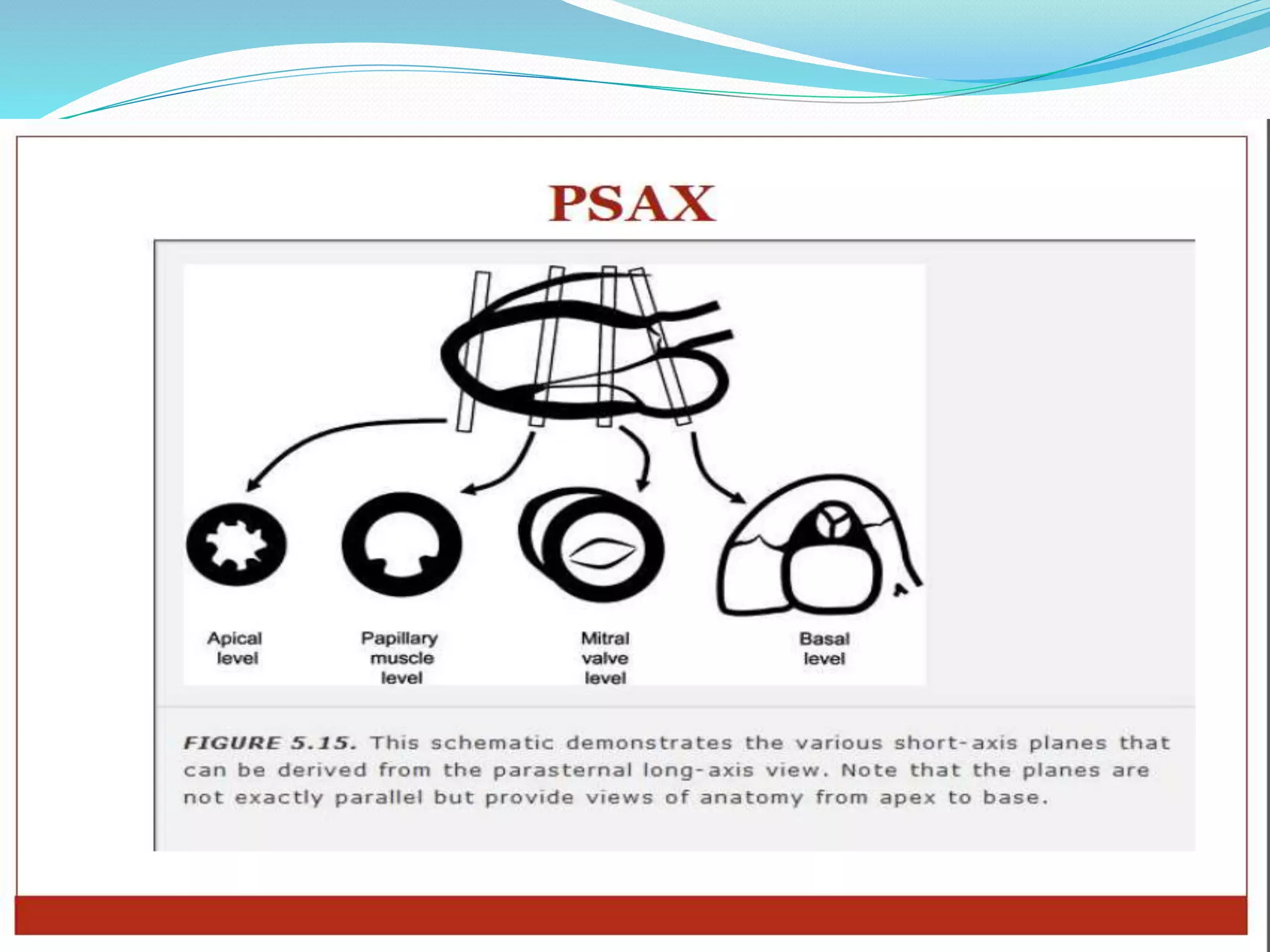 Basic echocardiography | PPTX