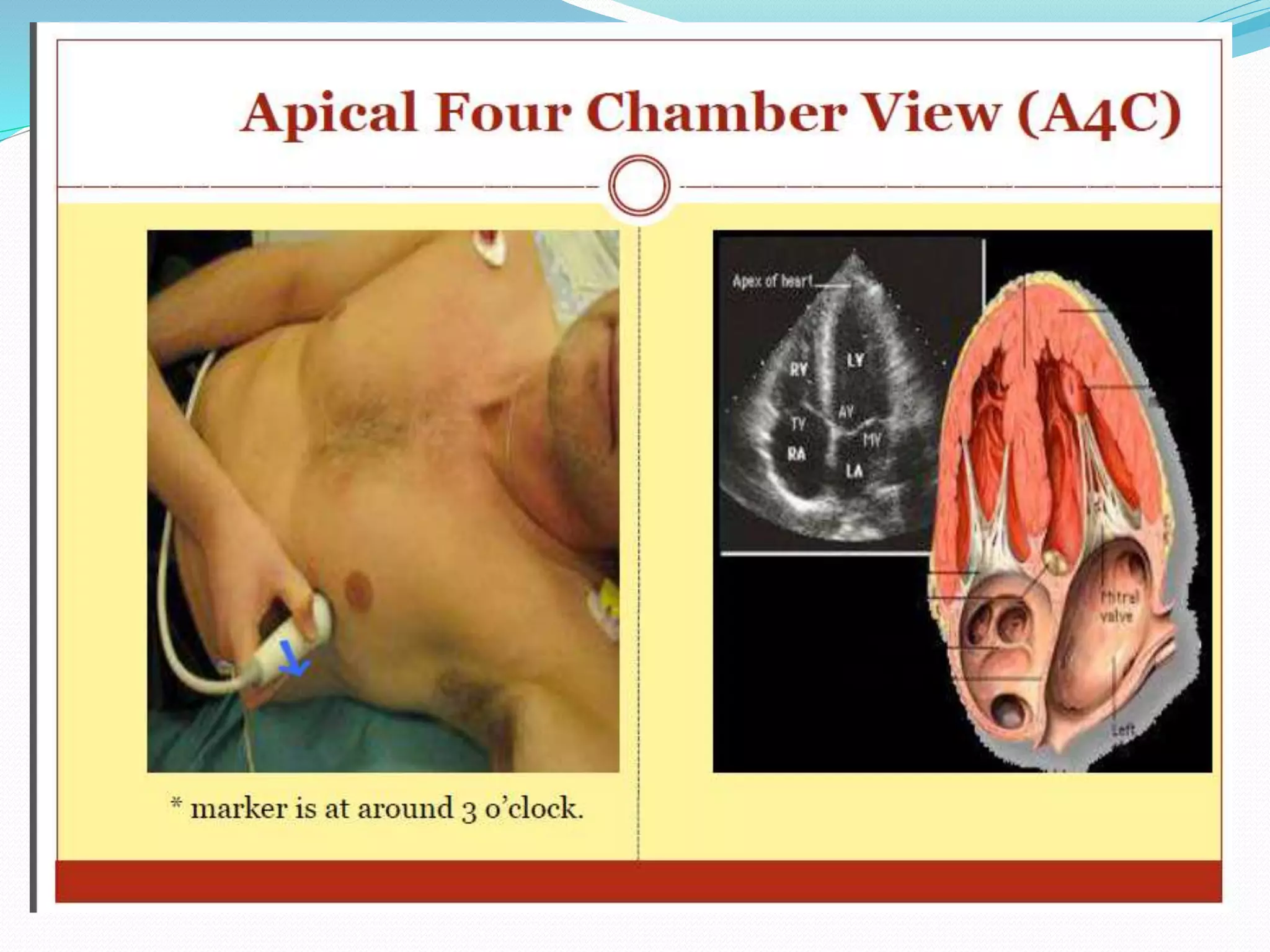 Basic echocardiography | PPTX