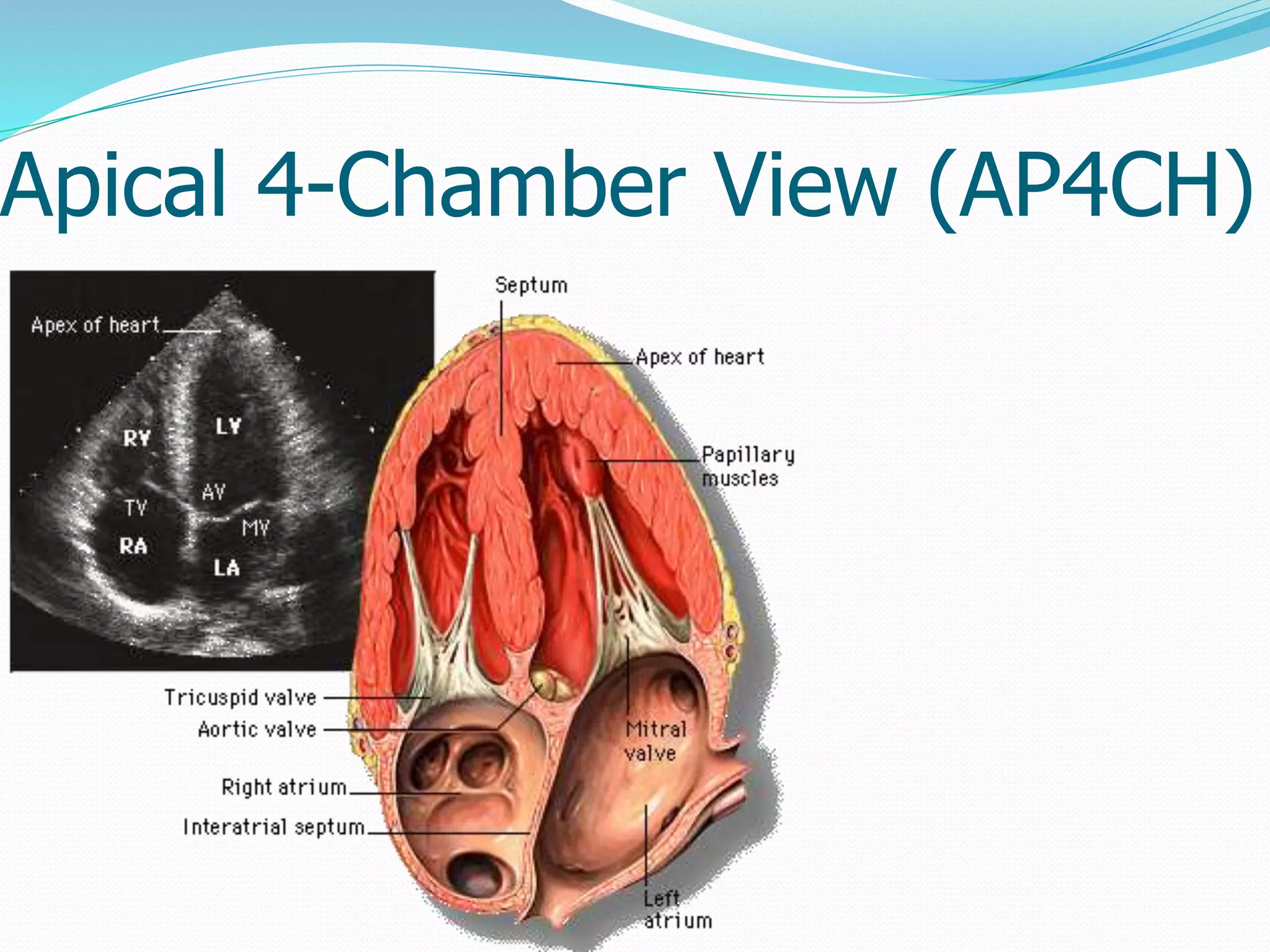 Basic echocardiography | PPTX