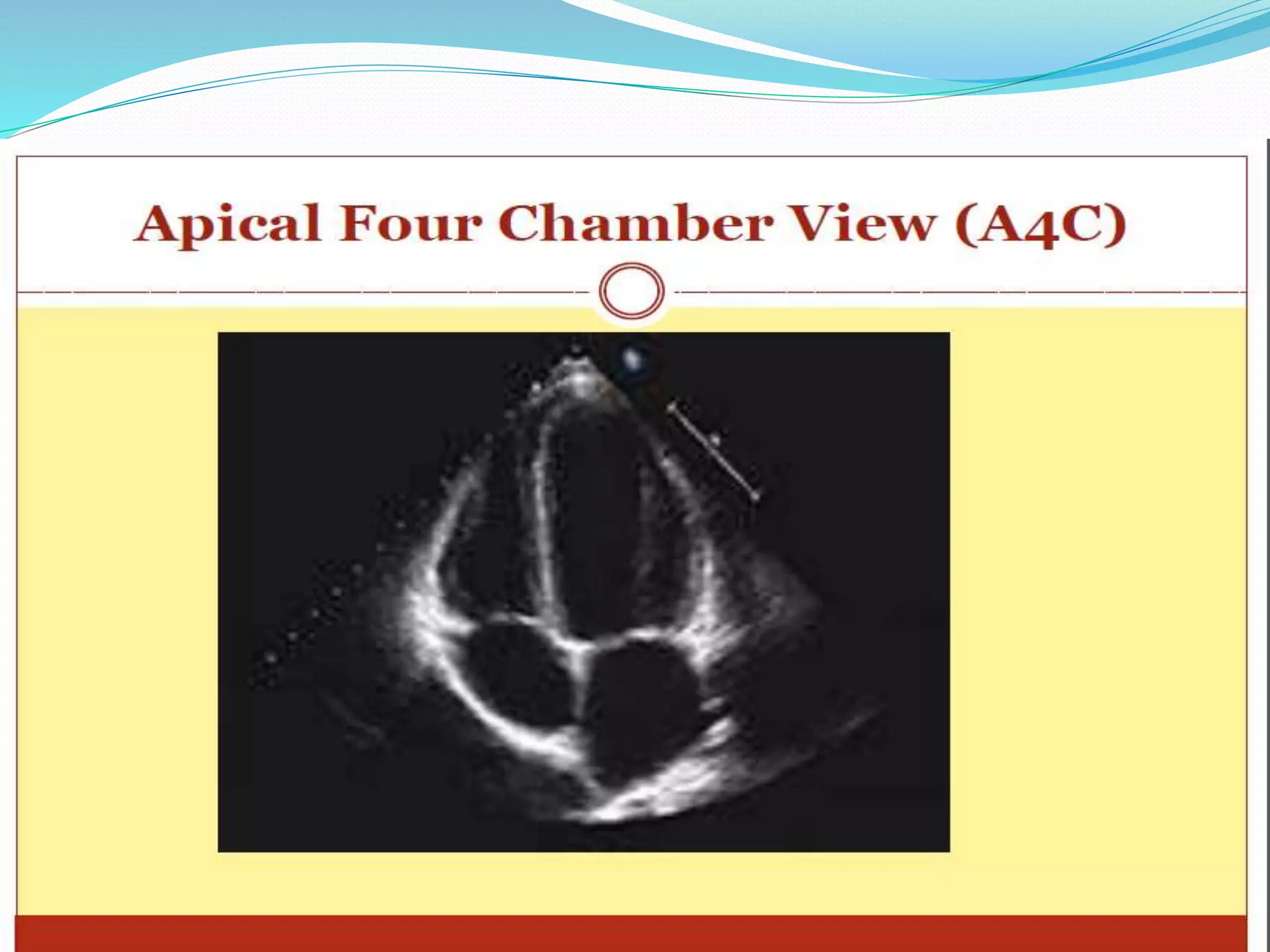 Basic echocardiography | PPTX