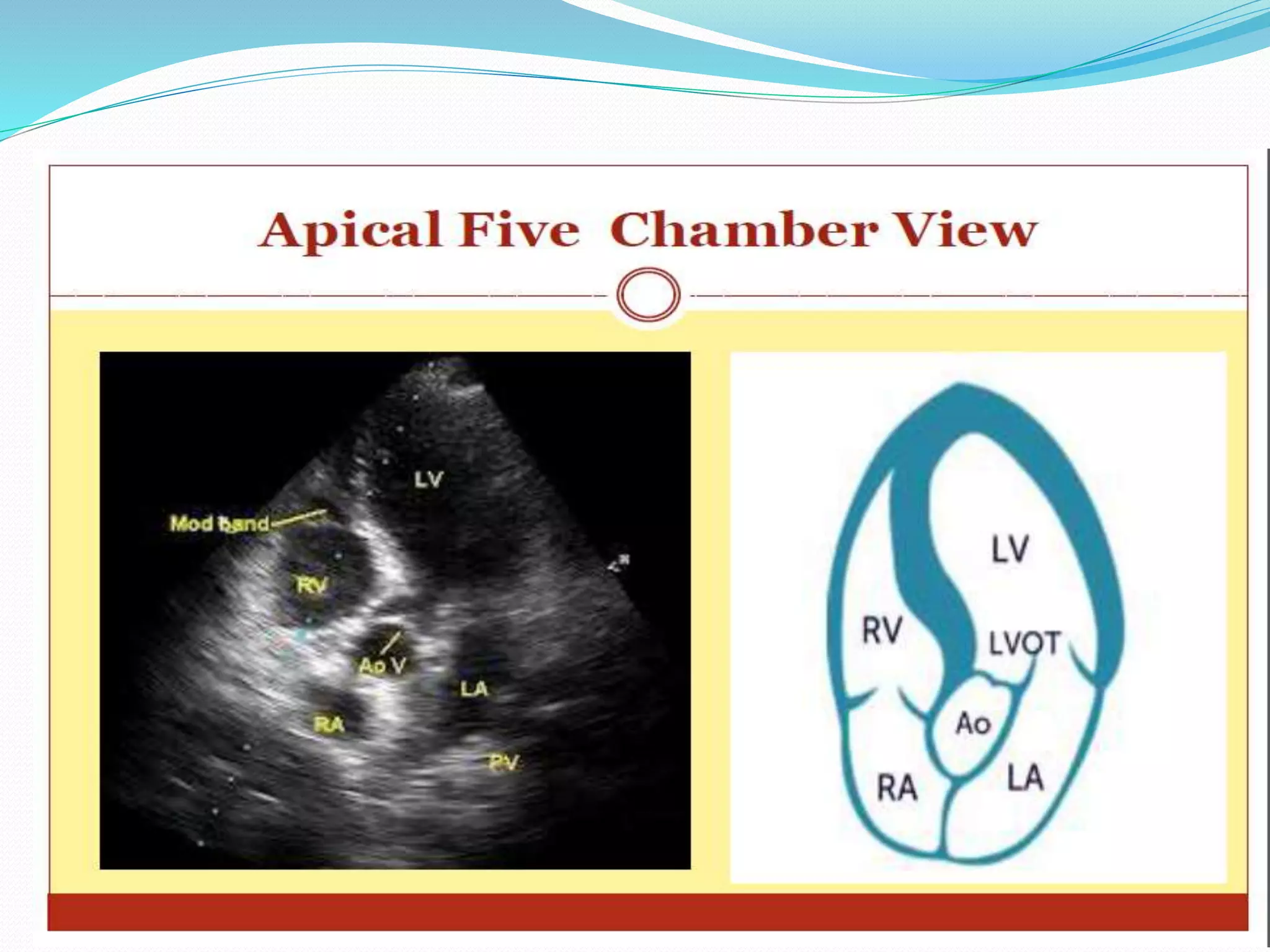 Basic echocardiography | PPTX