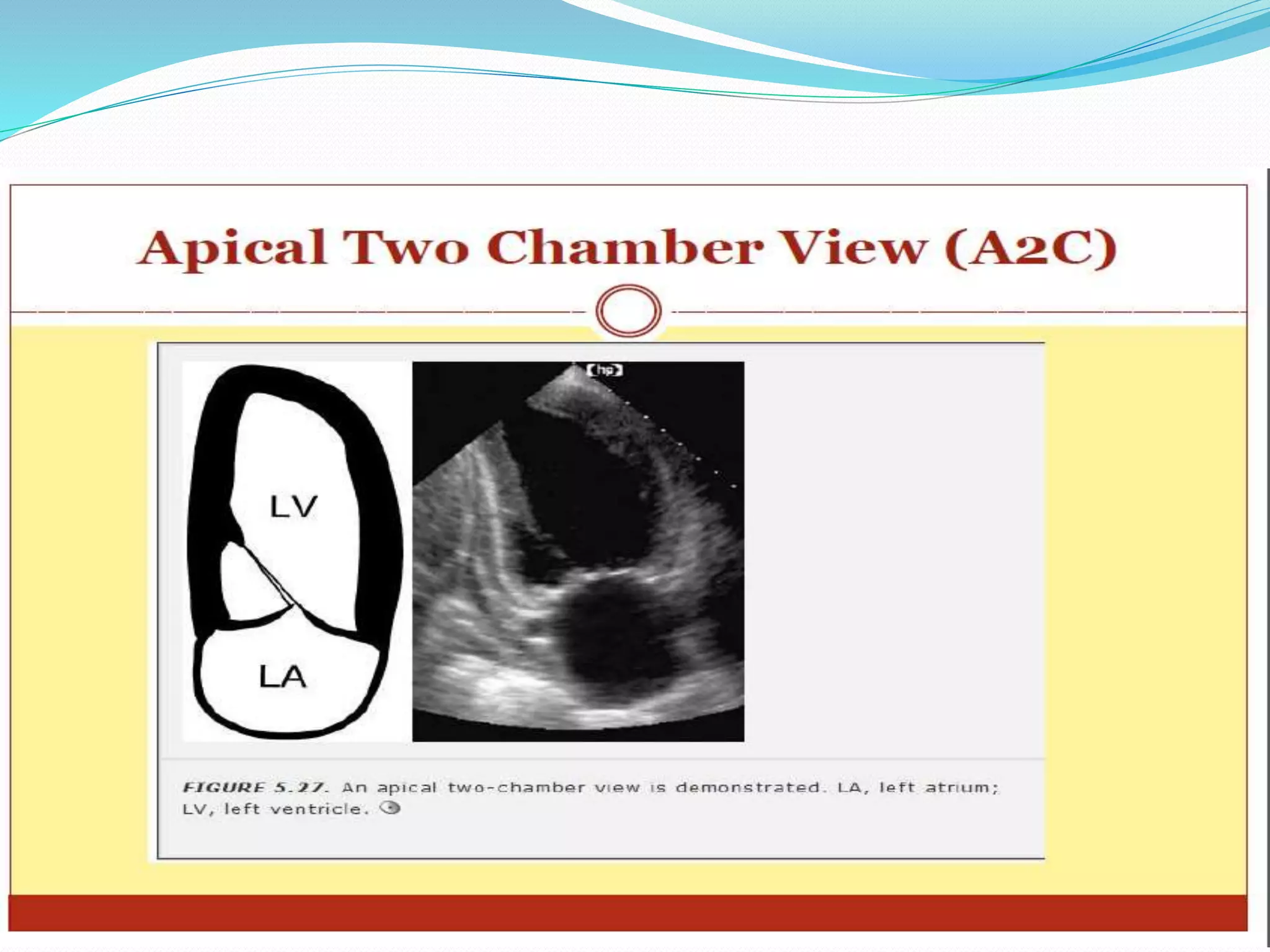 Basic echocardiography | PPTX
